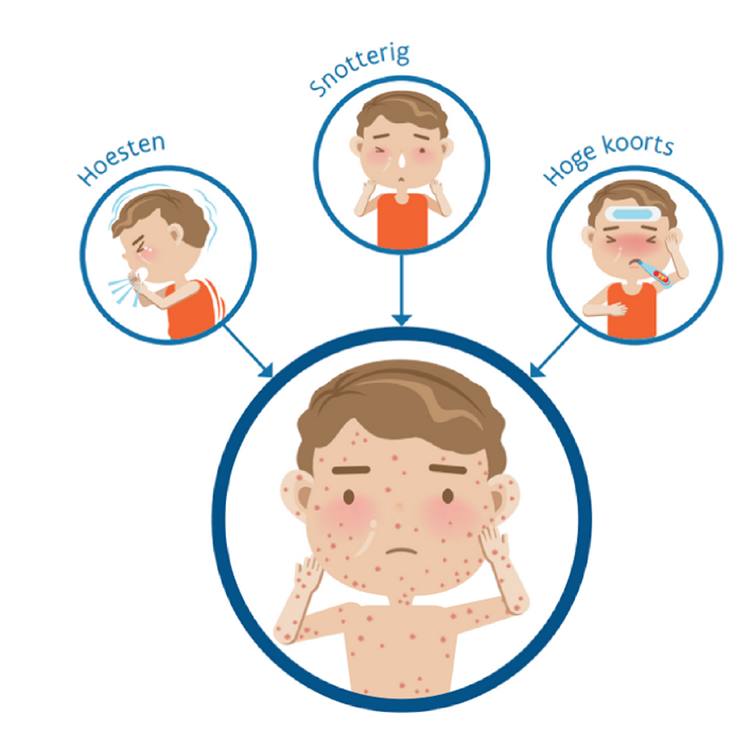 Eerste hulp bij mazelen! | Speelplein.Net
